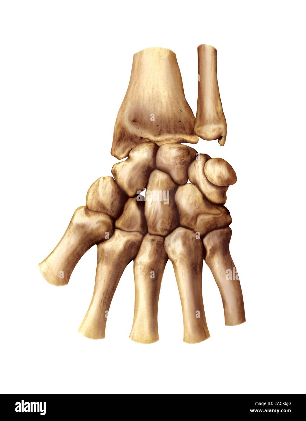 Illustration of the bones of wrist and metacarpus. This right hand ...