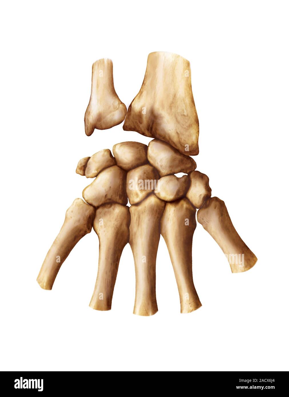 Illustration of the bones of wrist and metacarpus. This right hand ...