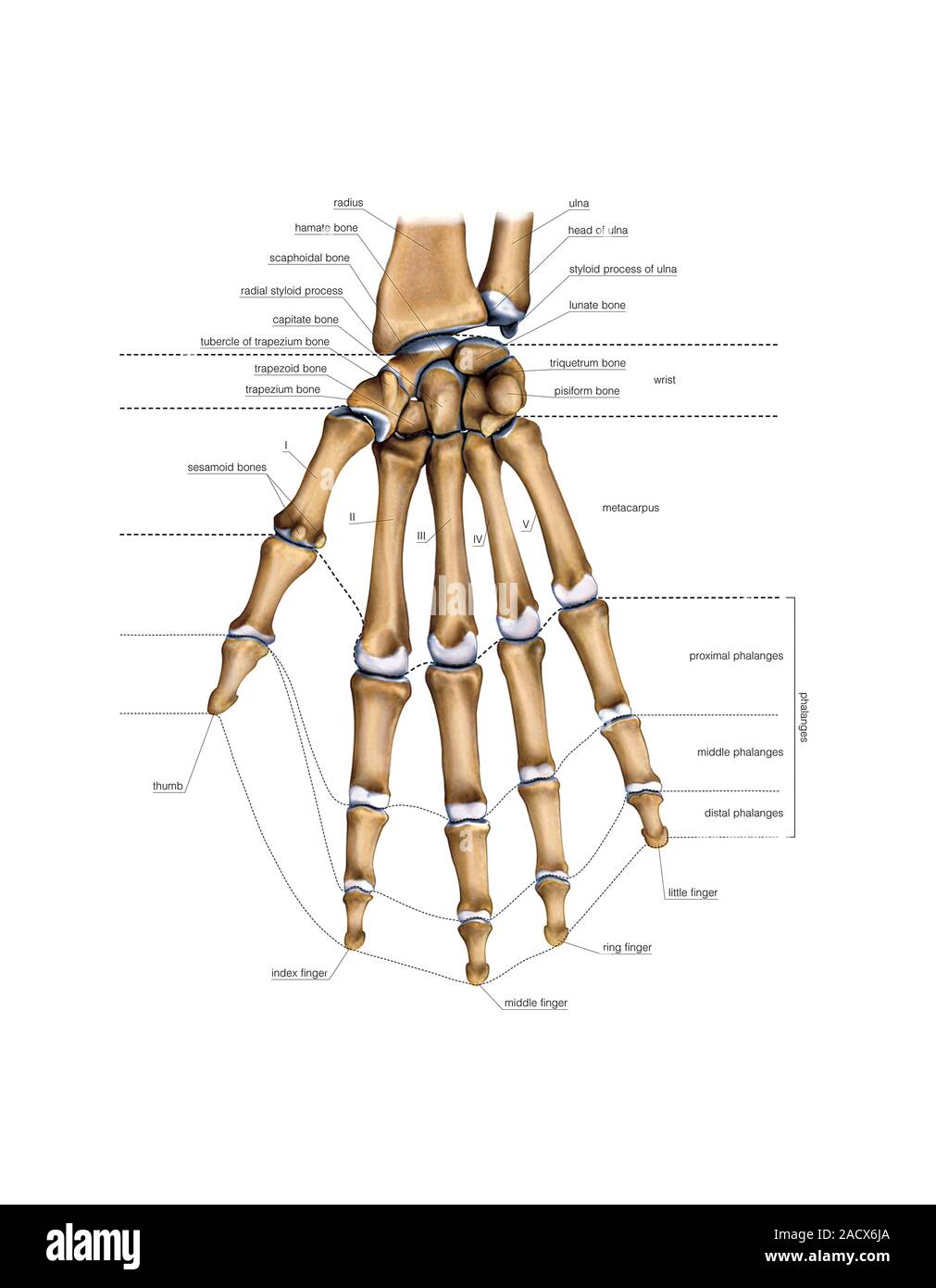 Illustration of the bones hand. This right hand palmar view labelled ...