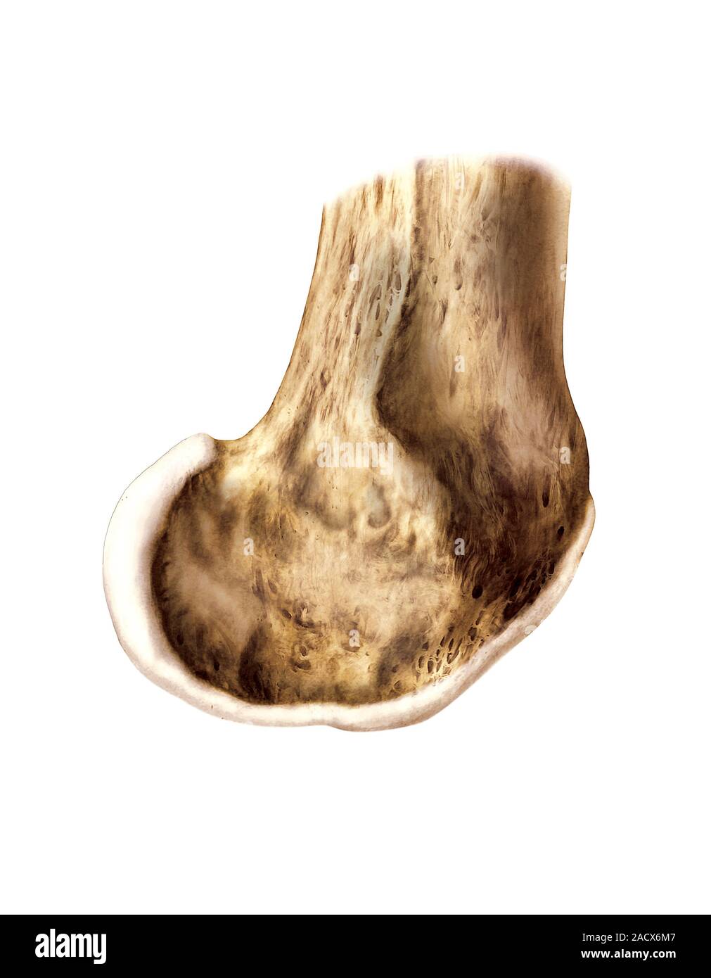 Illustration of distal extremity area of the femur. This lateral view ...