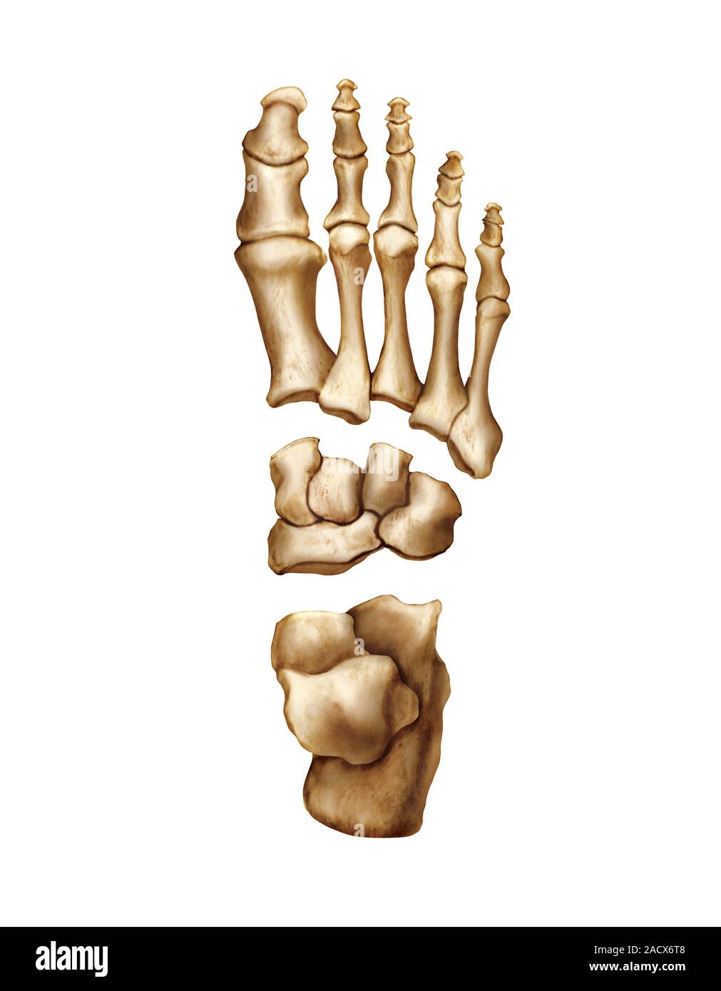 Illustration of the talipes or foot deformations from the anatomical ...