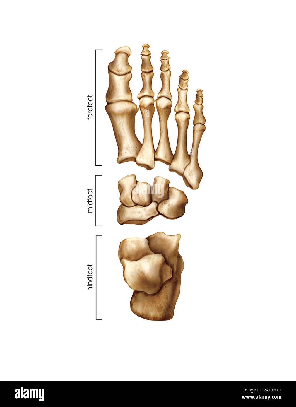 Illustration of the talipes or foot deformations from the anatomical ...