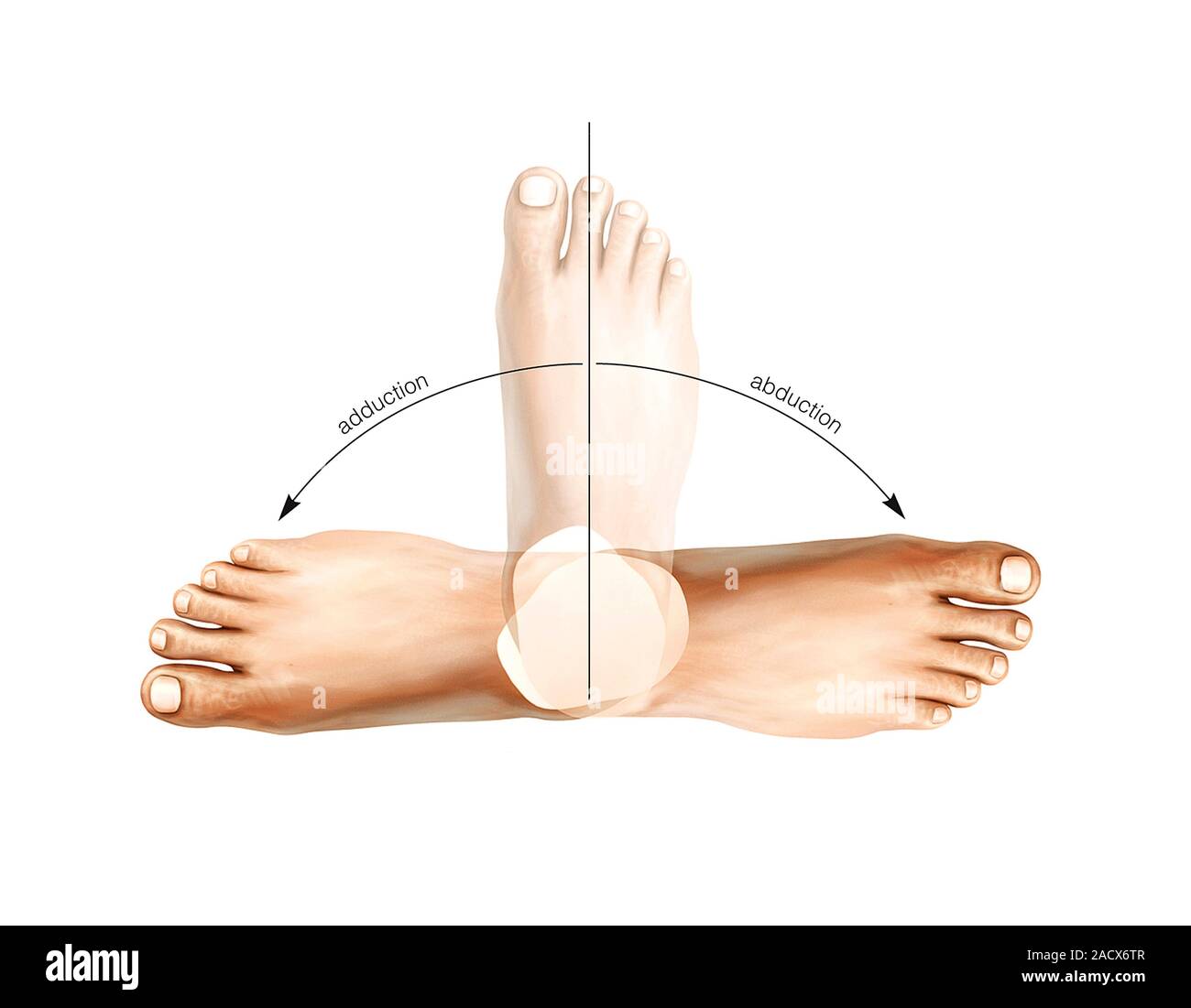 Illustration Of The Talipes Or Foot Deformations From The Anatomical