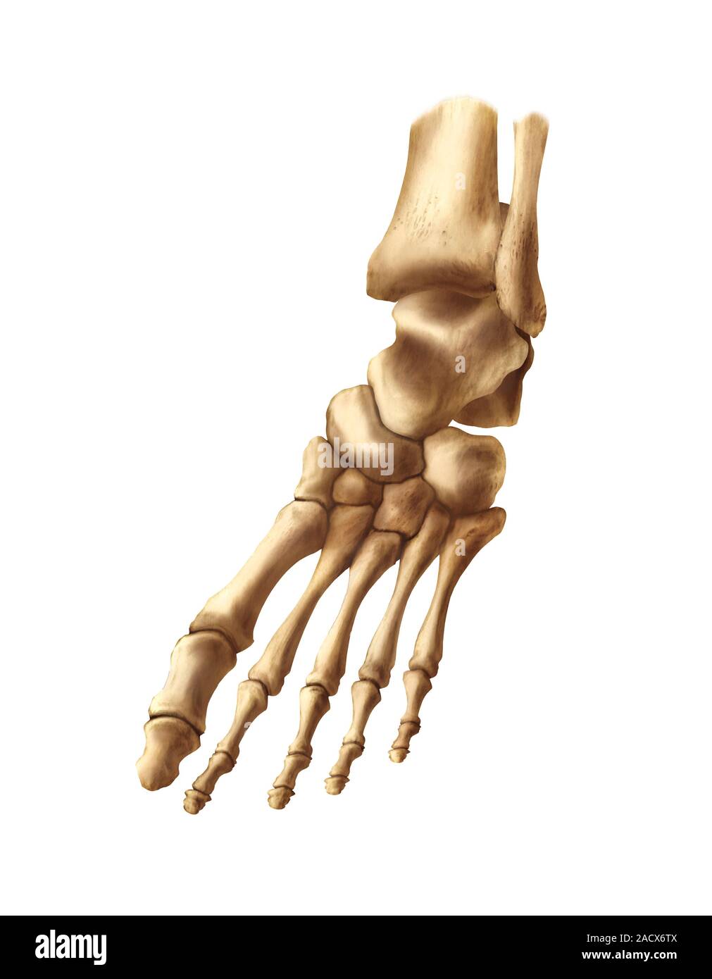 Illustration Of The Talipes Or Foot Deformations From The Anatomical