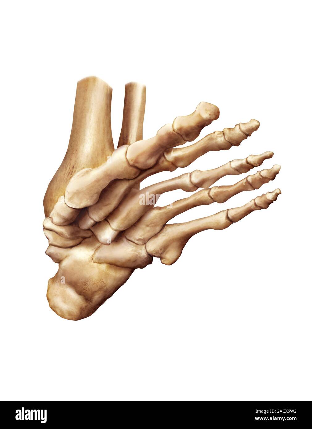 Illustration Of The Talipes Or Foot Deformations From The Anatomical