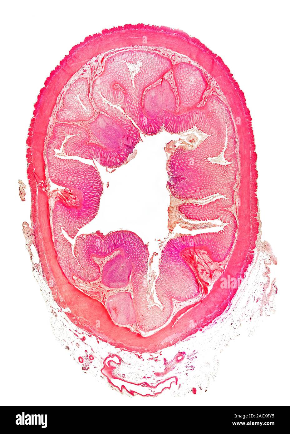 Appendix. Light micrograph of a transverse section through a human ...