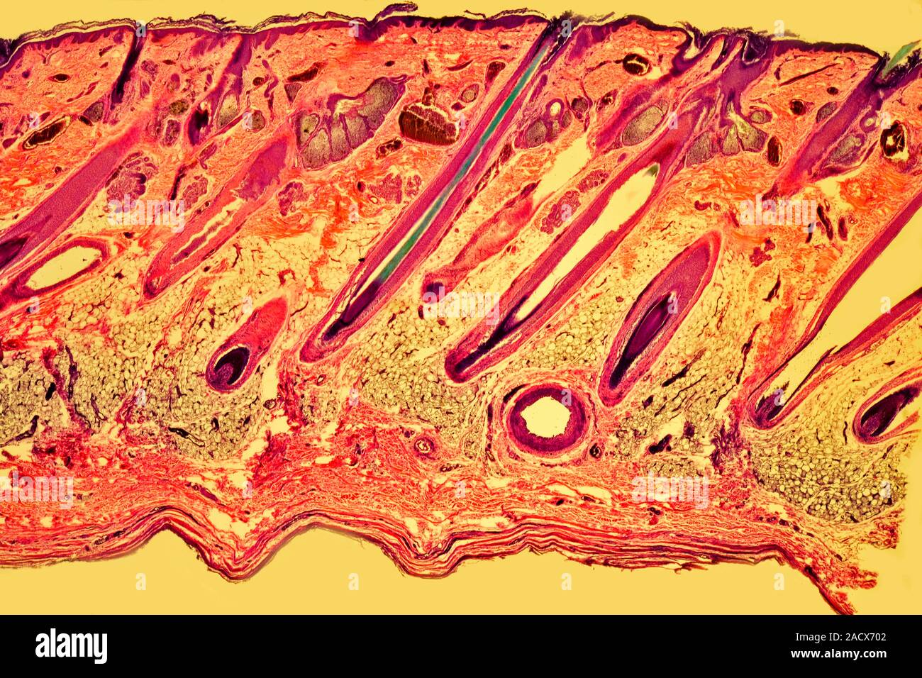 Skin. Polarised light micrograph of a transverse section through human ...