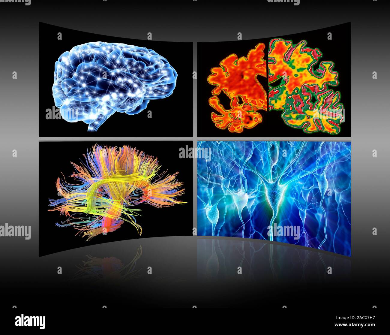 Brain research. Computer artwork showing a display wall with four ...