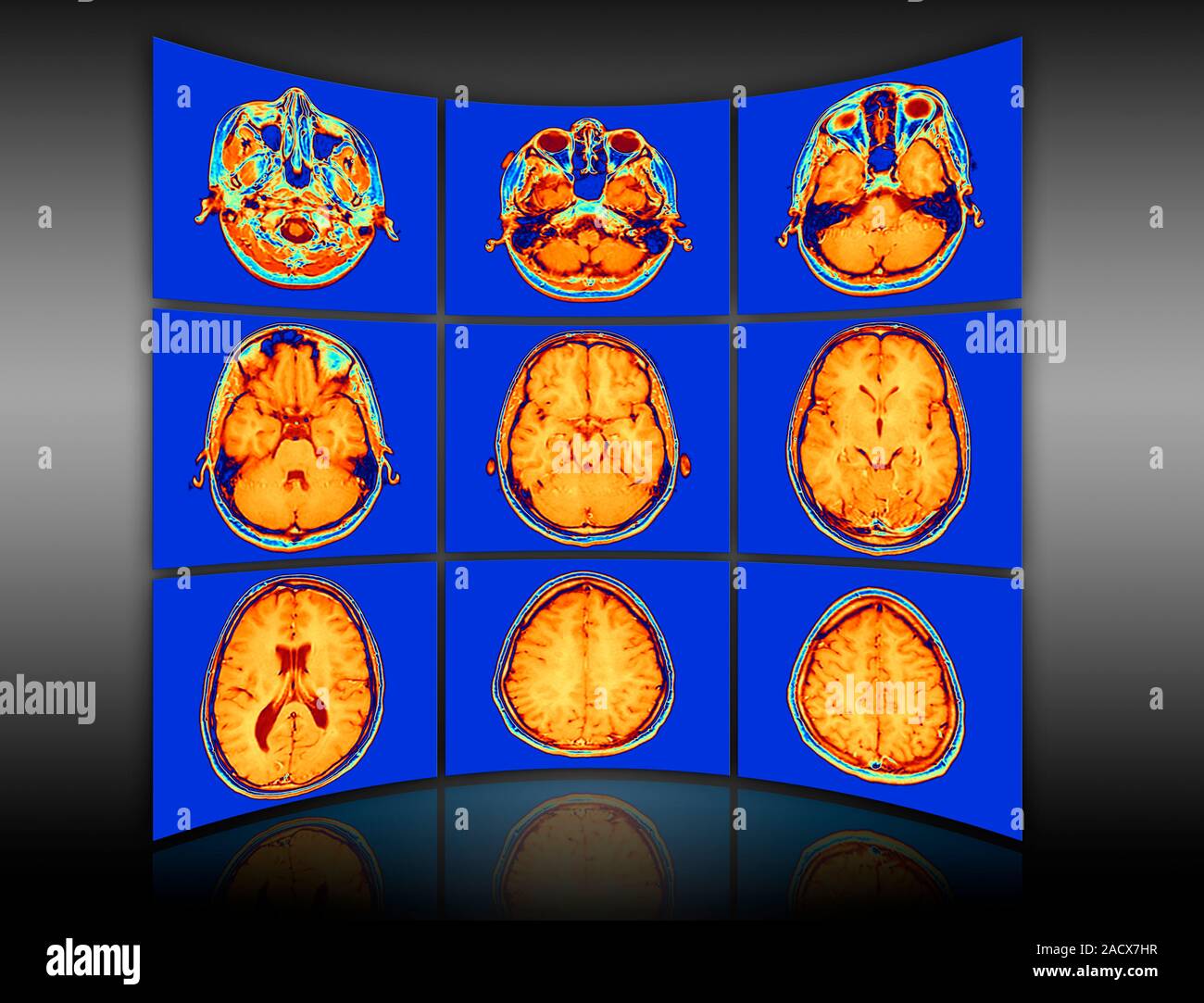 Computer artwork of a display wall, showing a series of nine false ...