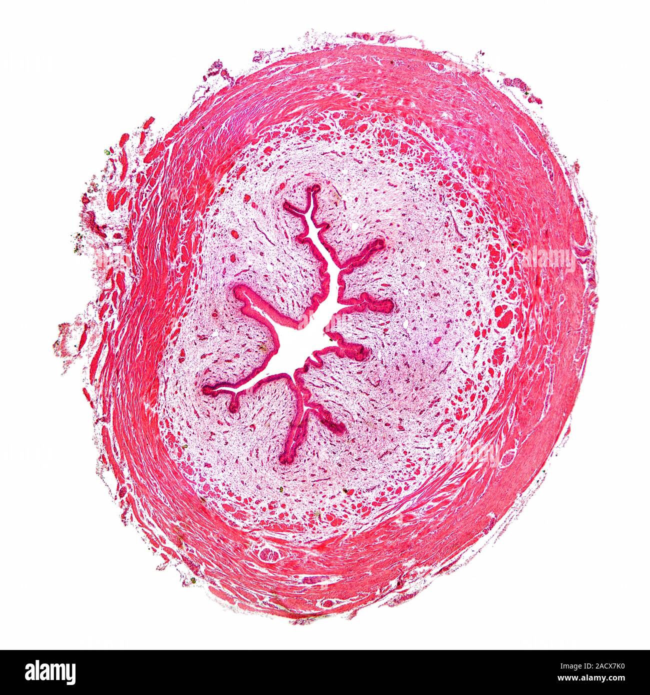 Ureter. Light micrograph of a transverse section through a human ureter ...