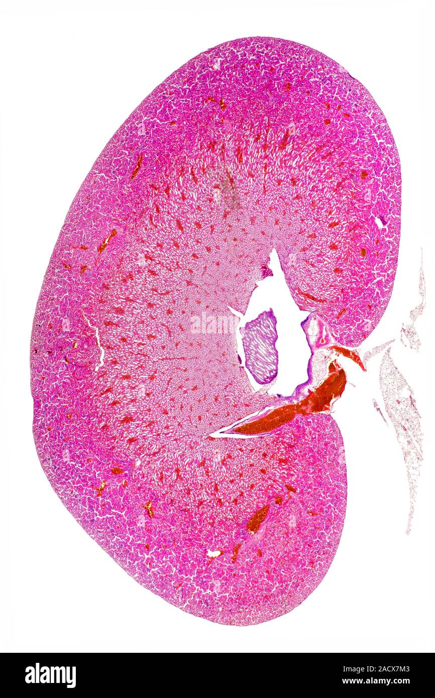 Kidney. Light micrograph of a longitudinal section through a kidney from a young weasel. The ...