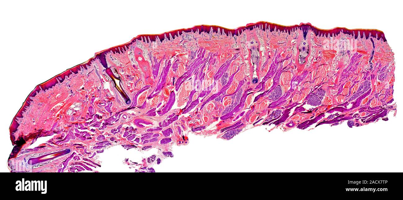 Pig skin. Light micrograph of a section through skin from the snout of ...