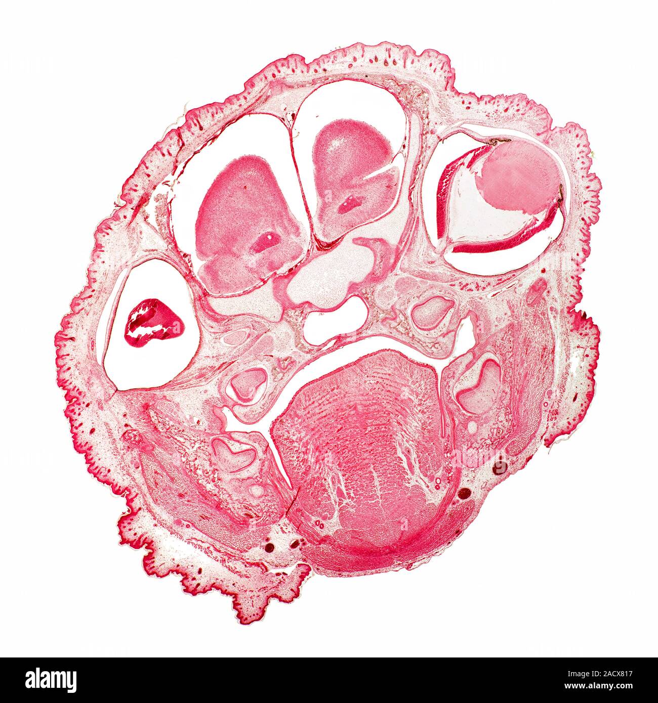 Foetal rat head. Light micrograph of a section through the head of a ...