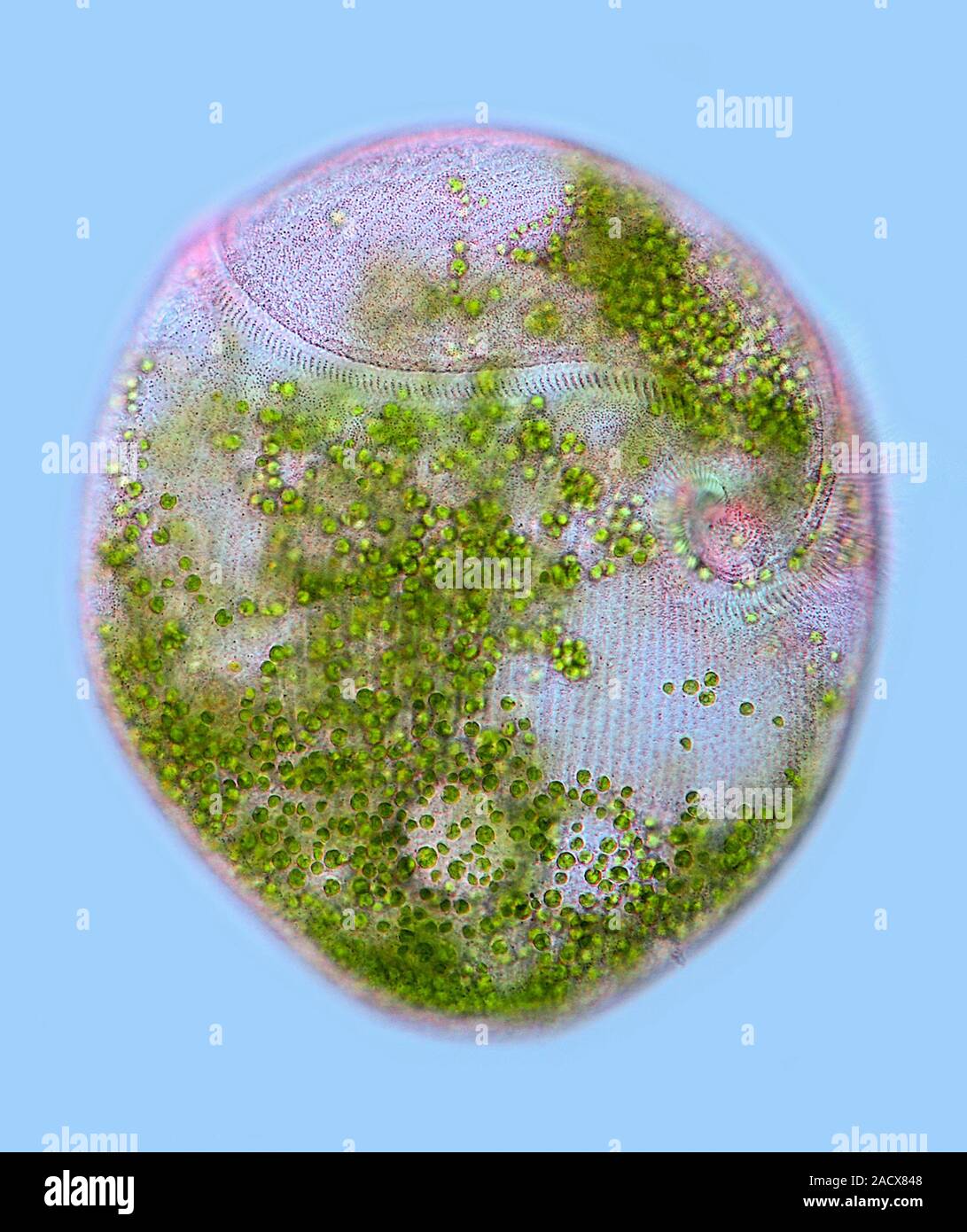 Polarised light micrograph of a Stentor sp. freshwater ciliate ...