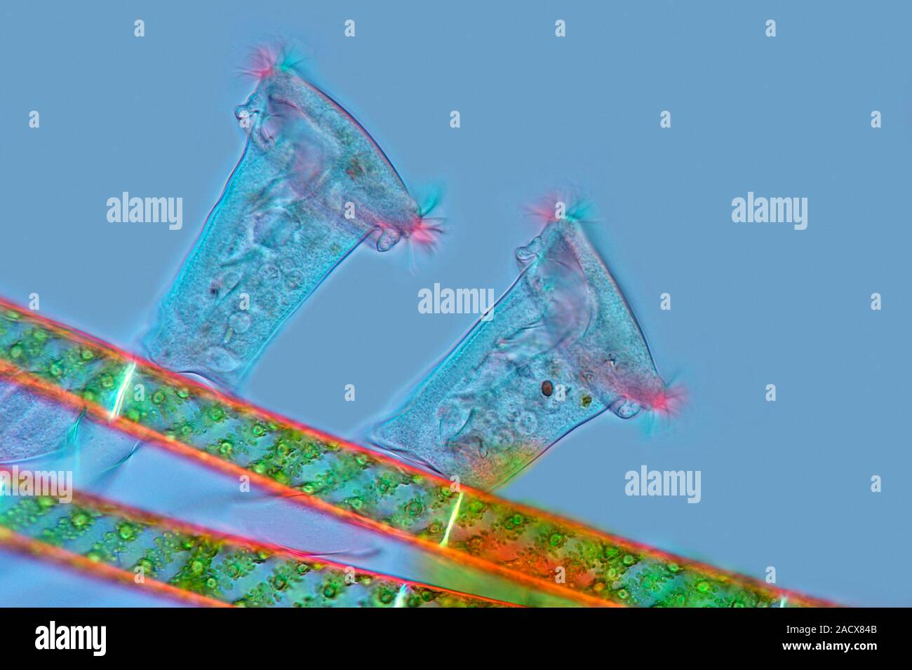 Polarised light micrograph of Epistylis sp. protozoa. They are sessile ...
