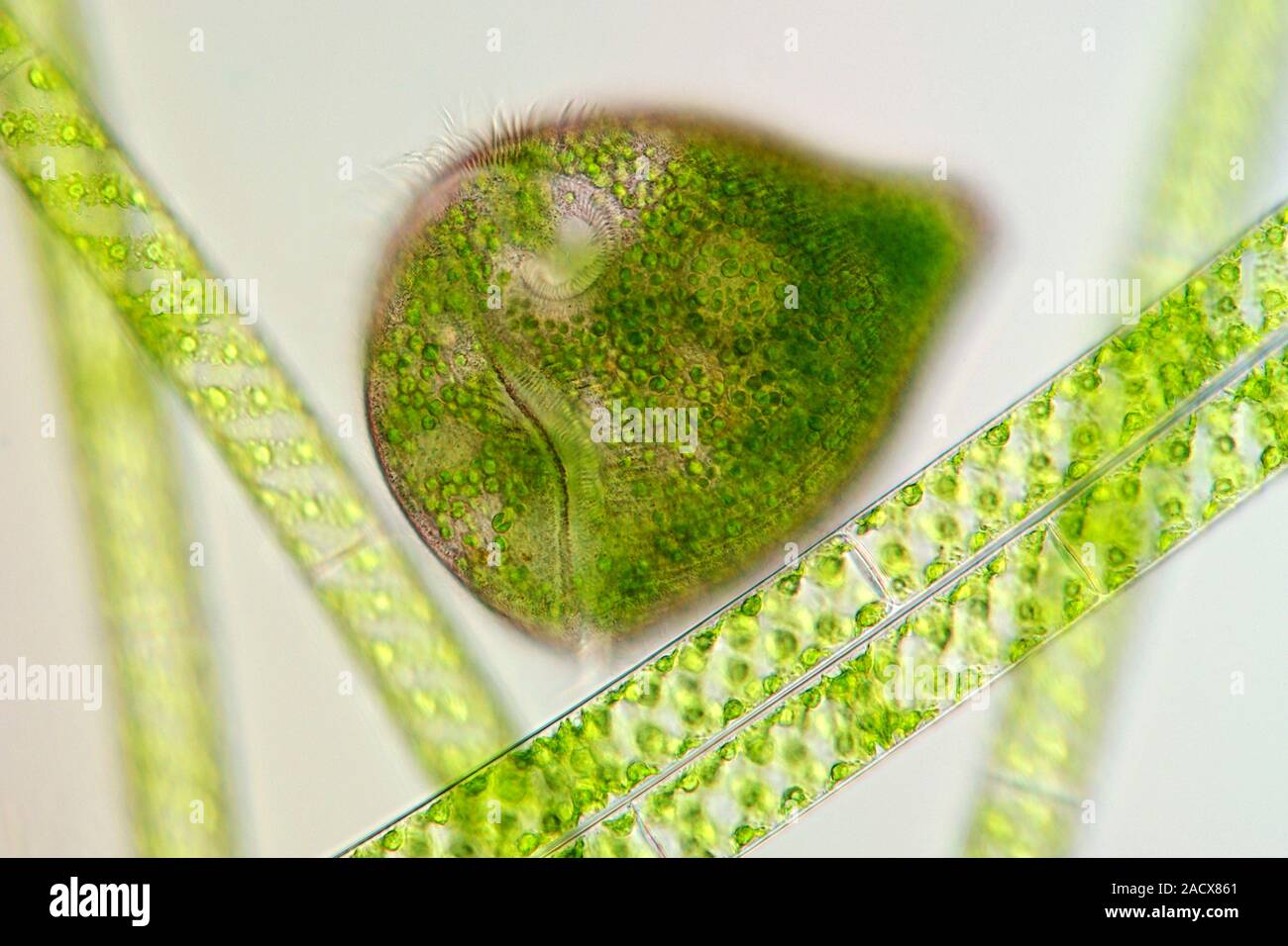 Polarised light micrograph of a Stentor sp. freshwater ciliate ...