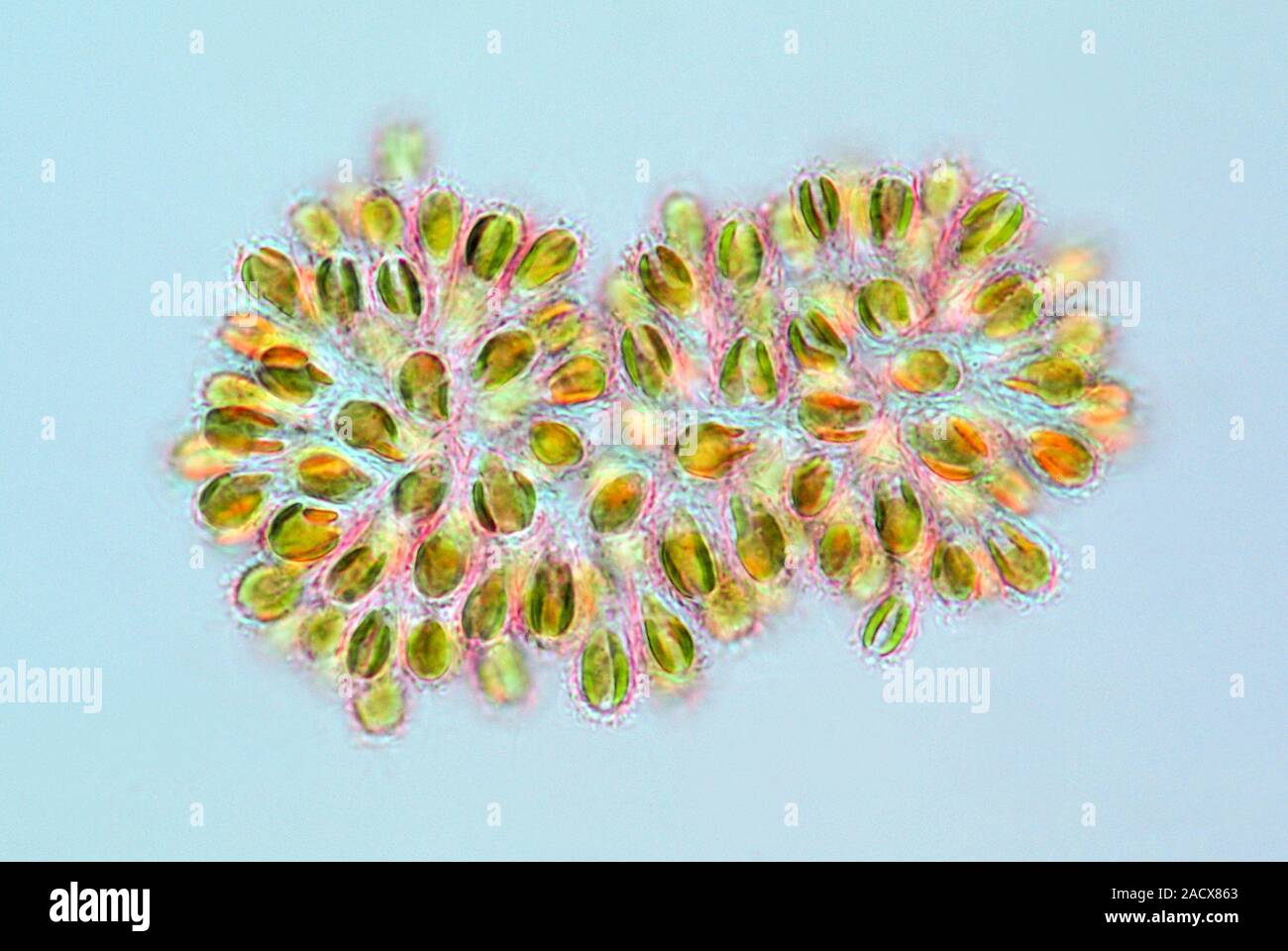 Golden-brown algae. Polarised light micrograph of two Synura uvella ...
