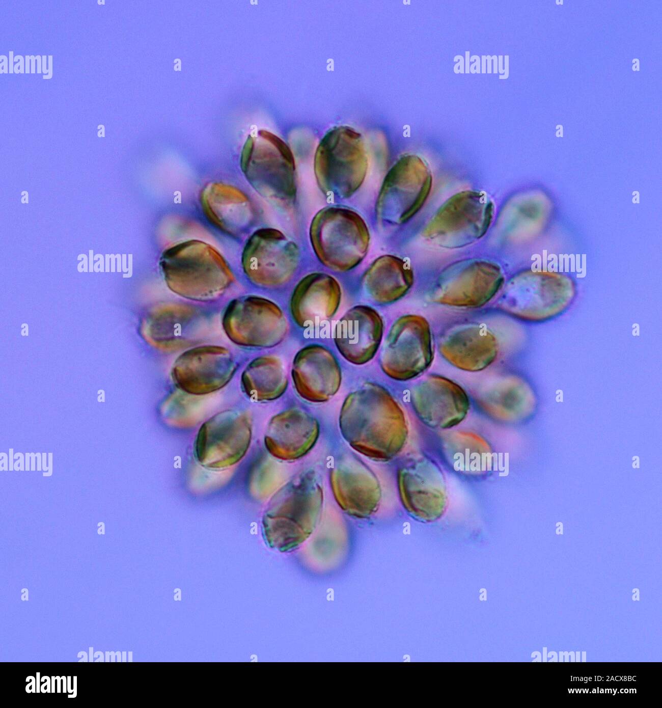 Golden-brown algae. Polarised light micrograph of a Synura uvella ...