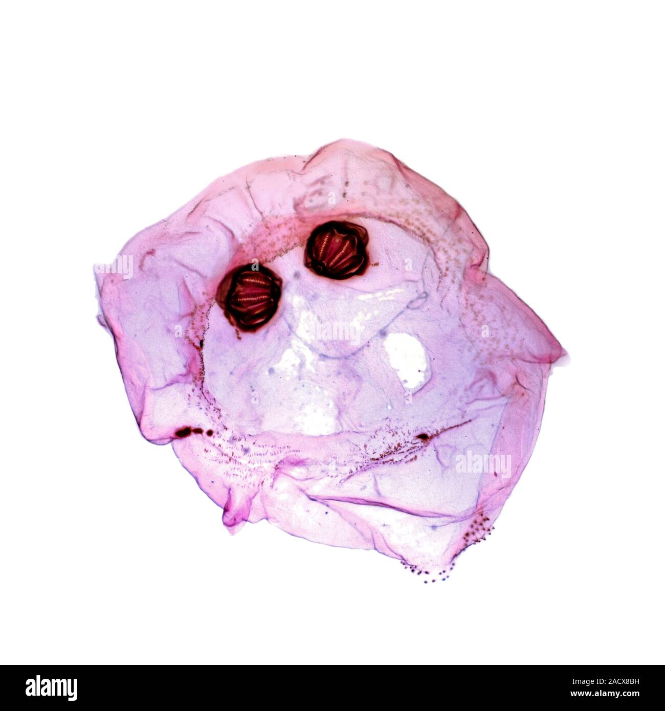 Blowfly (Calliphora sp.) maggot, light micrograph. This is the rear end ...