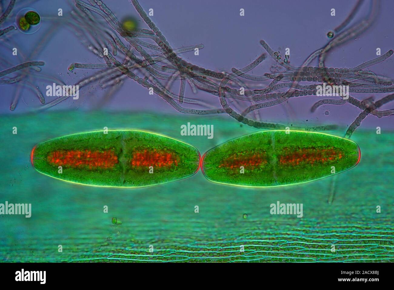 Polarised light micrograph of two Netrium sp. desmids on a moss ...