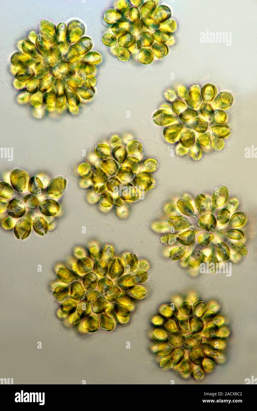 Golden-brown algae. Polarised light micrograph of several Synura uvella ...