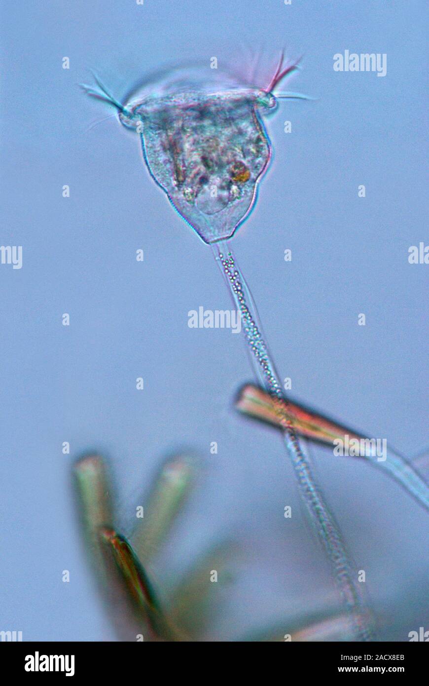 Polarised light micrograph of a Vorticella sp. peritrich ciliate ... Polarised light micrograph of a Vorticella sp. peritrich ciliate ...
