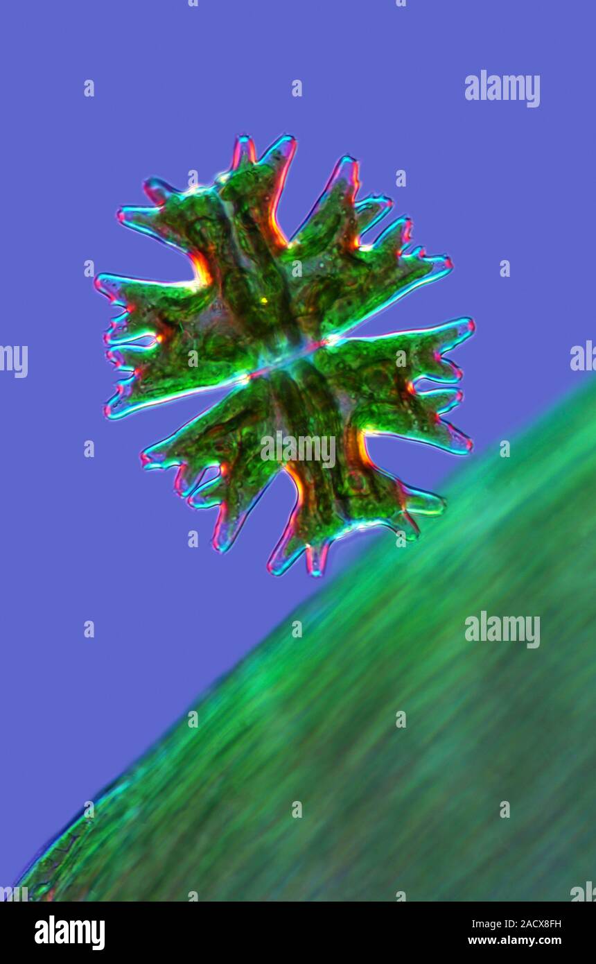 Polarised light micrograph of a Micrasterias sp. desmid, a freshwater ...