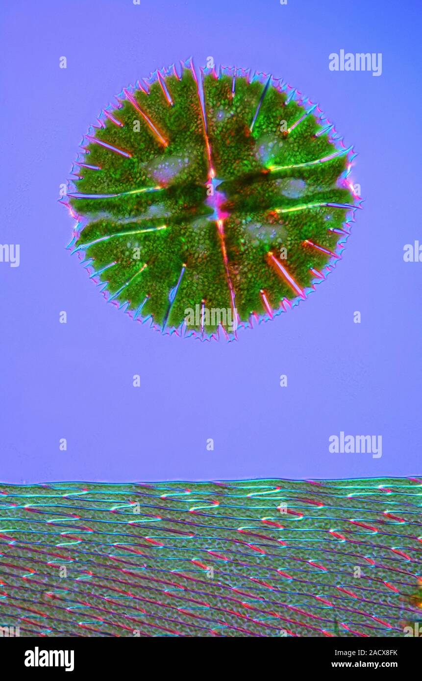 Polarised light micrograph of a Micrasterias sp. desmid, a freshwater ...