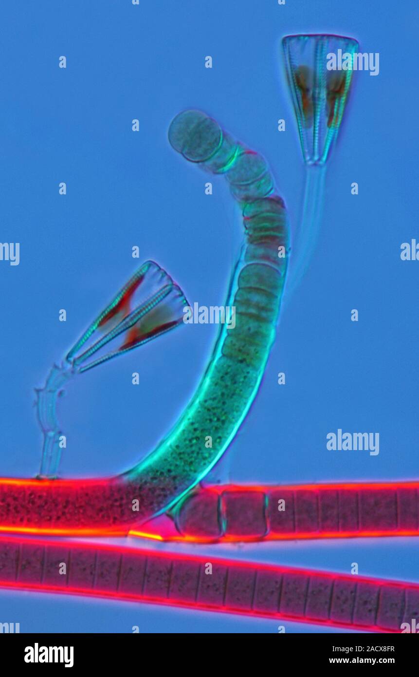 Polarised light micrograph of Gomphonema sp. diatoms (triangular) and ...