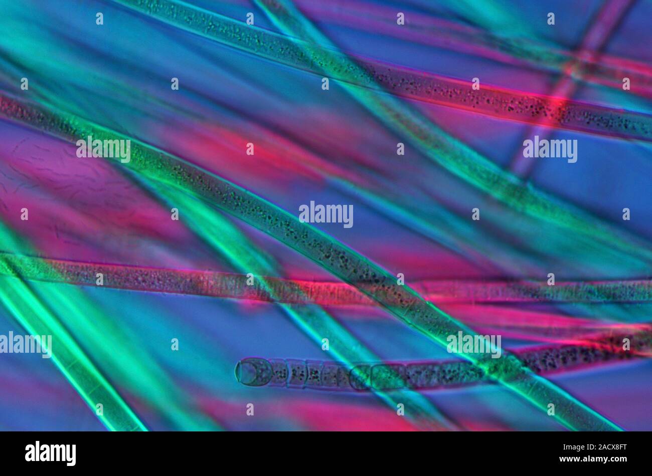 Cyanobacteria, polarised light micrograph. Cyanobacteria are ...