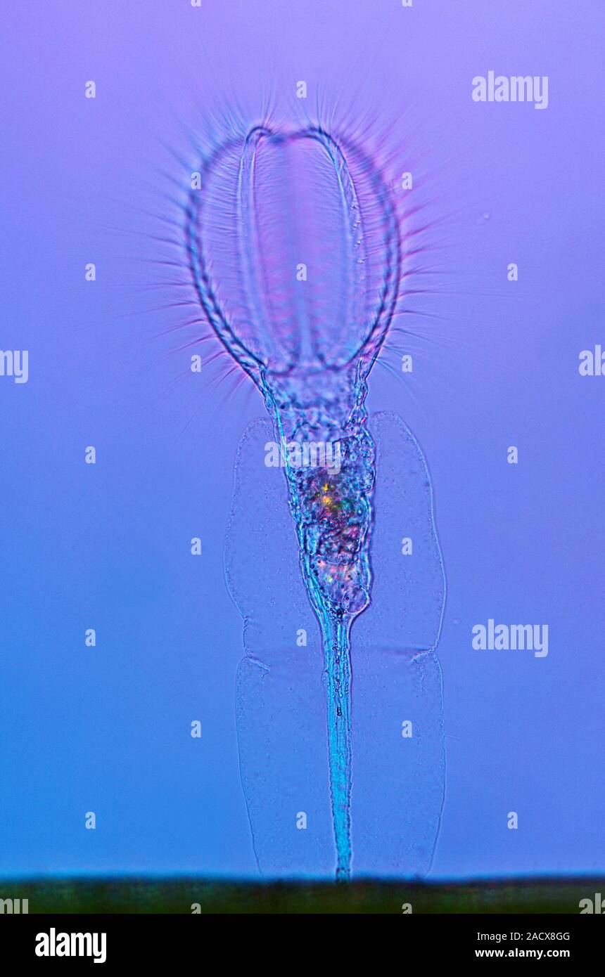 Polarised light micrograph of a Stephanoceros fimbriatus rotifer. Also ...