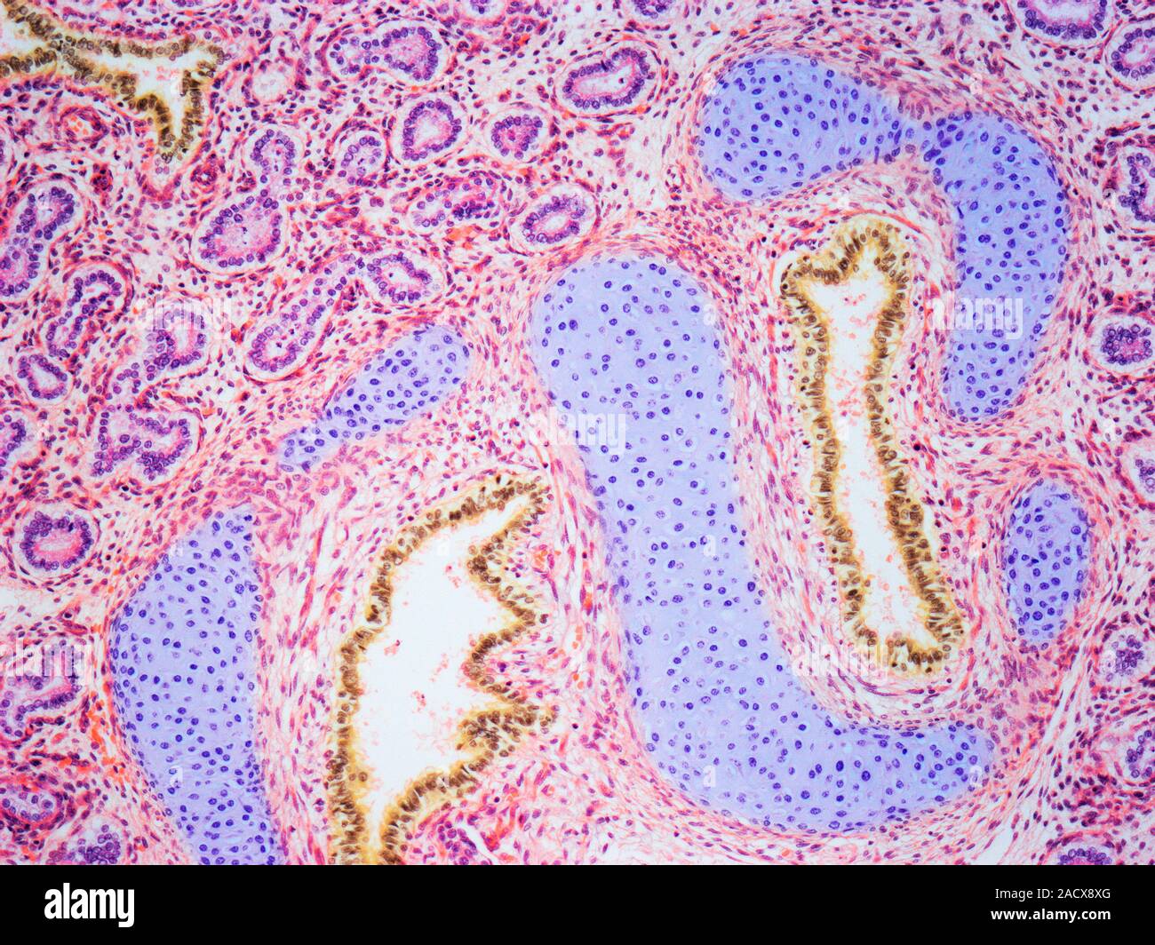 Fetal lung, light micrograph of a section from a human fetal lung at 34 ...