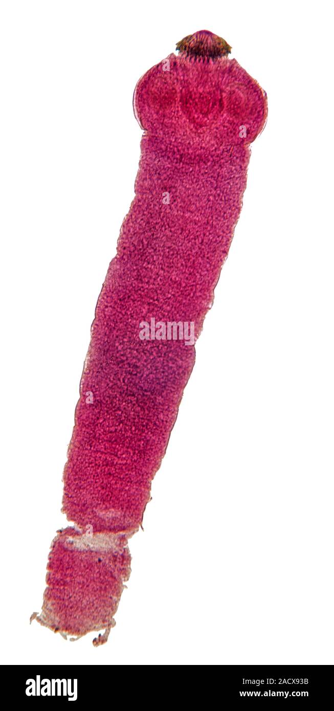 Tapeworm cysticercus. Light micrograph of the bladder worm or ...
