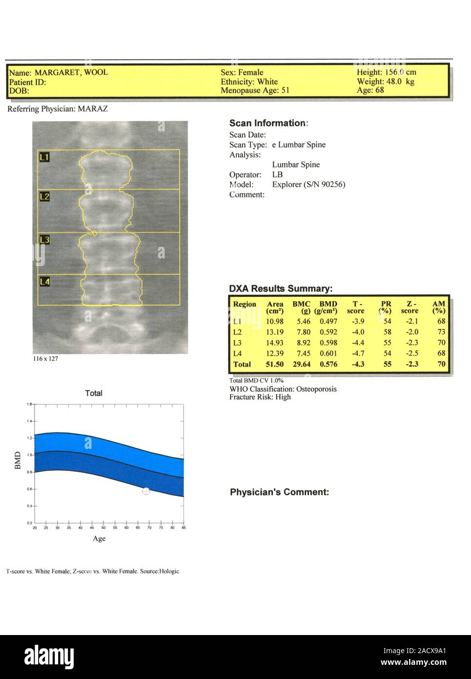 Dual Energy X-ray Absorptiometry (DEXA) scan of a 68 year old female ...