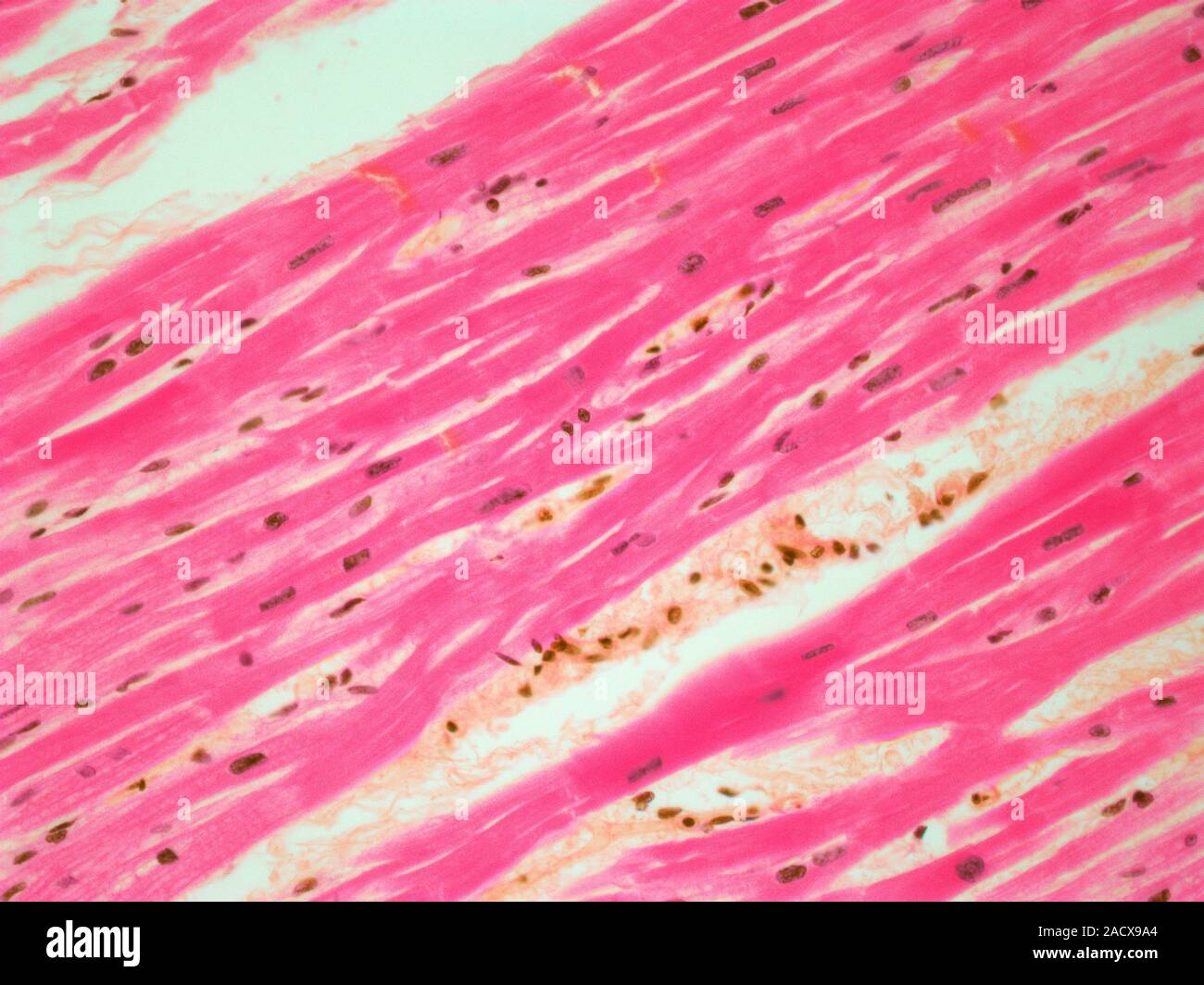Human cardiac muscle, light micrograph of a section of healthy heart ...