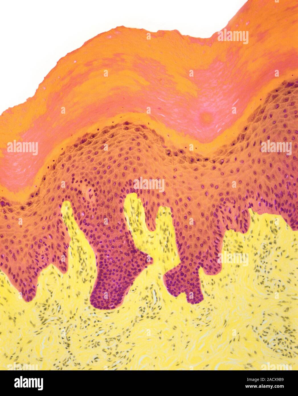 Human fingertip, light micrograph of sectioned skin. The skin on the ...