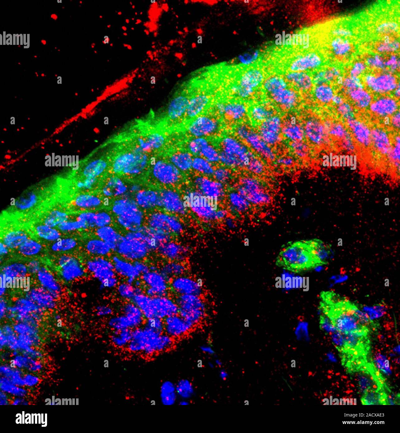 Epidermis, fluorescent light micrograph. The epidermis is the outermost ...