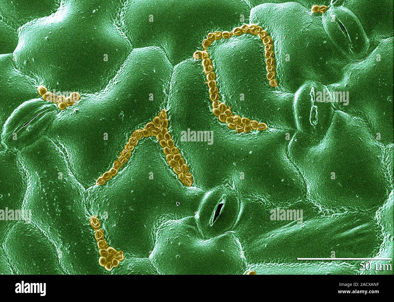 Cryptosporidium Sp On A Spinach Leaf Coloured Scanning Electron