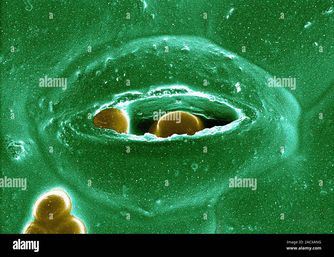 Cryptosporidium sp. in a spinach leaf stoma, coloured scanning electron ...