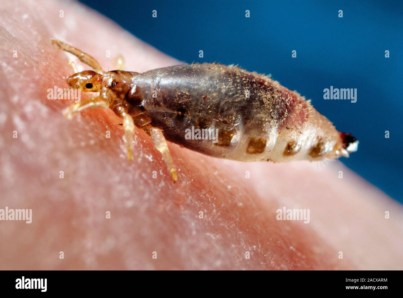 Female body louse (Pediculus humanus corporis), lateral view. This ...