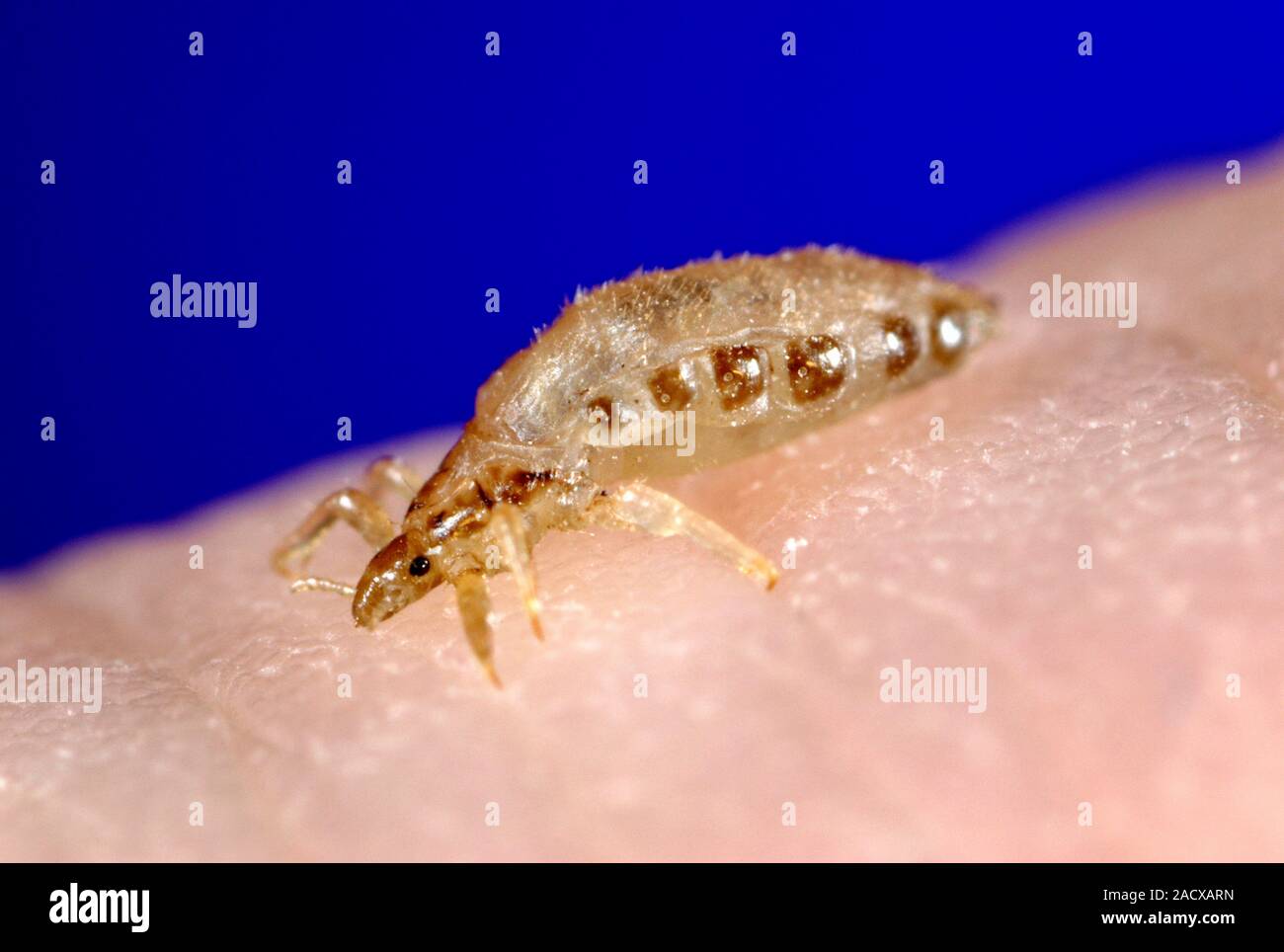 Male body louse (Pediculus humanus corporis), lateral view. This louse ...