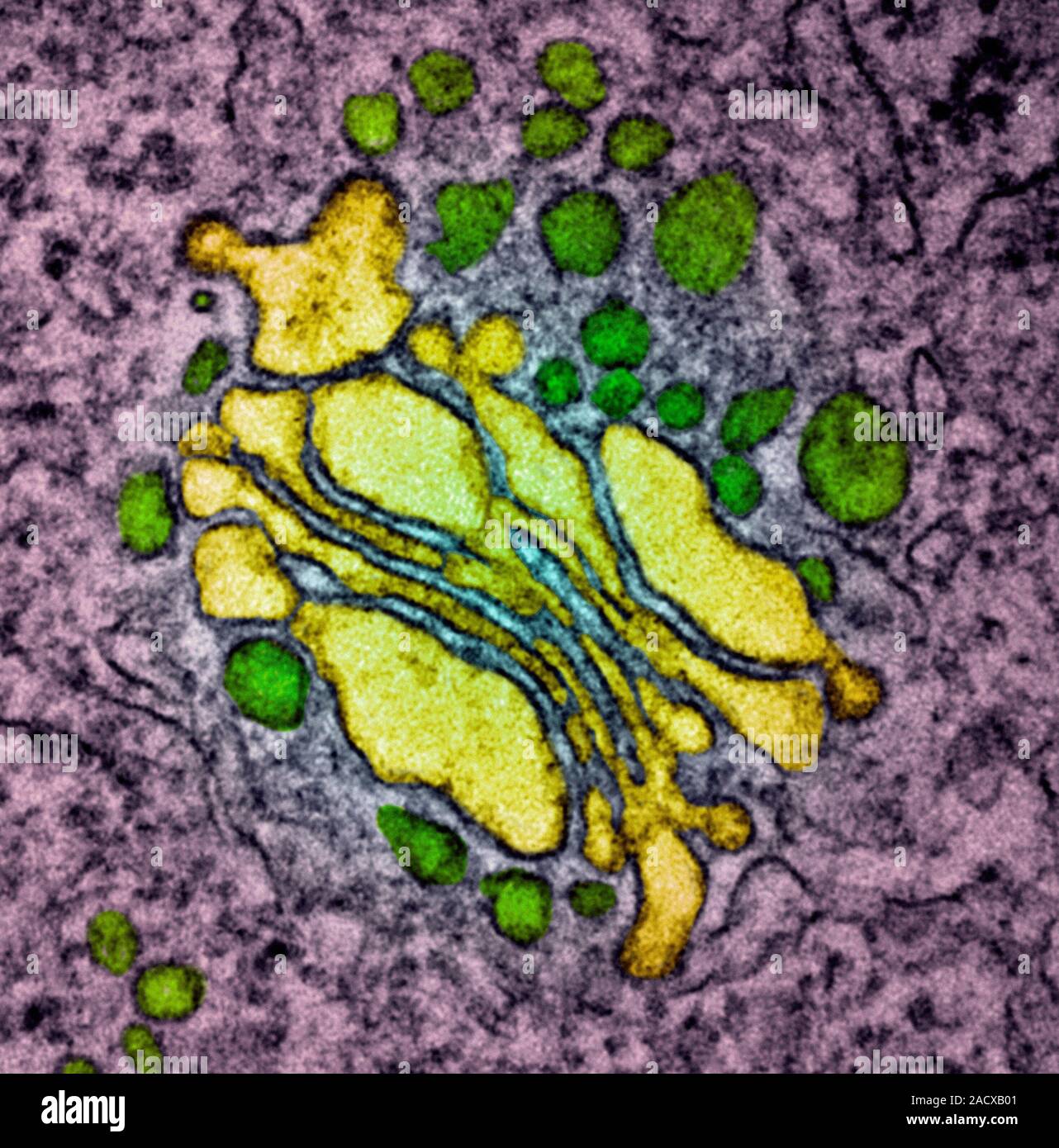 Golgi apparatus, coloured transmission electron micrograph (TEM). This ...
