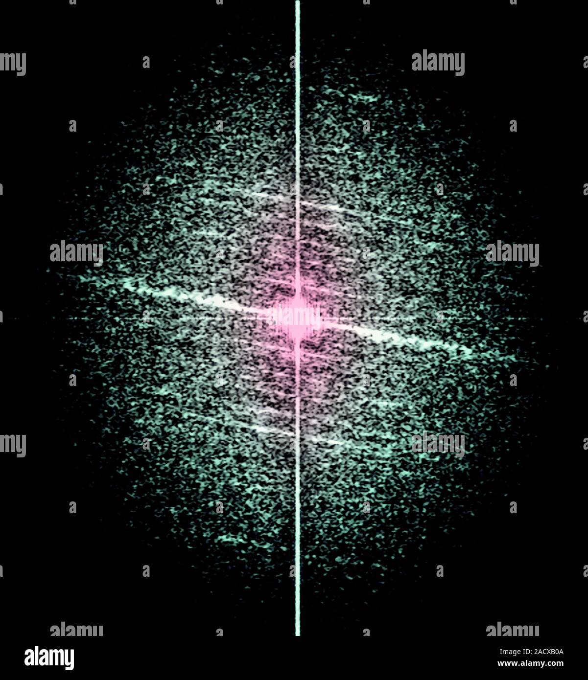 Flagellum of a Trypanosoma brucei protozoan, fast fourier transform ...