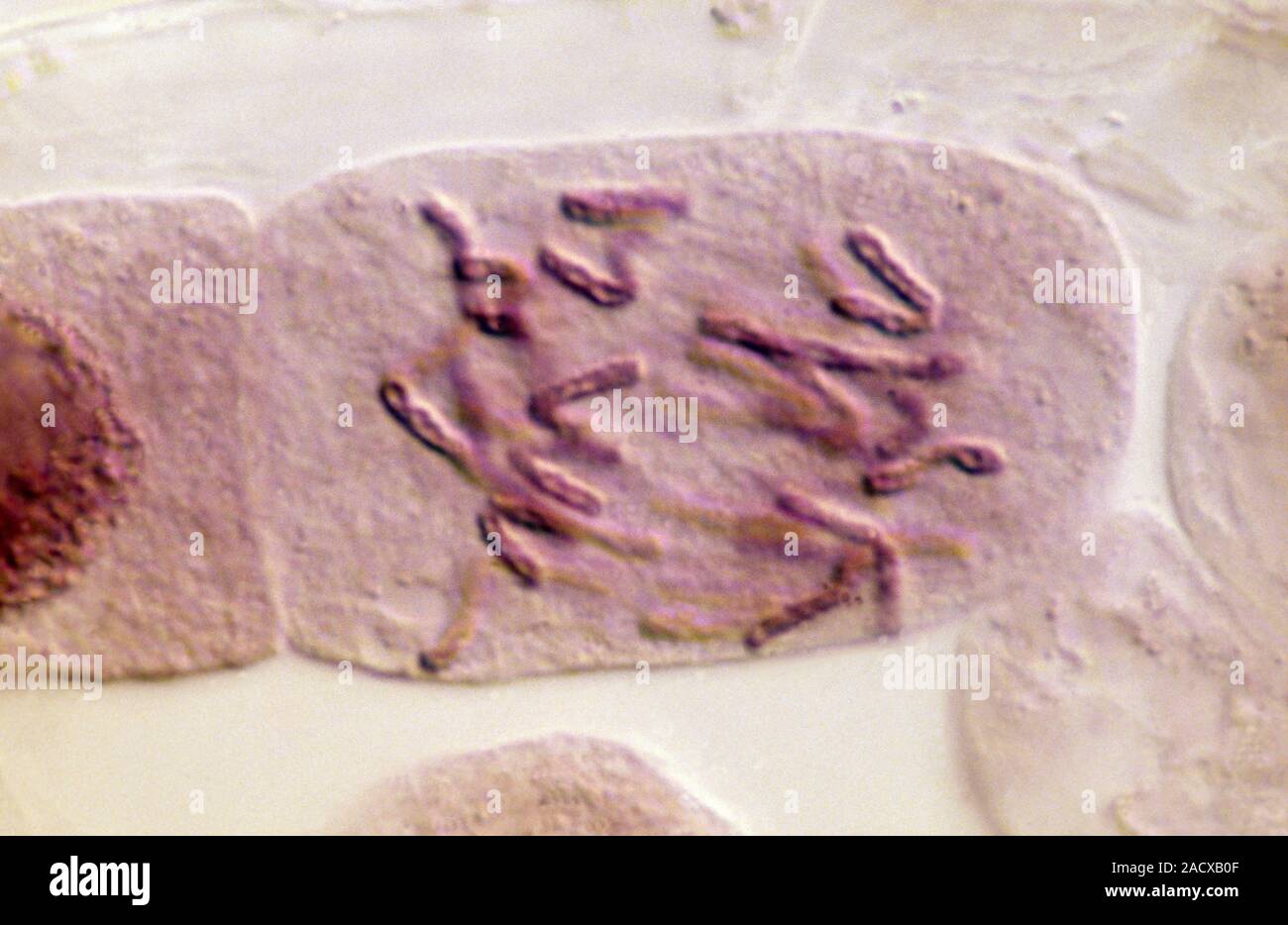 Plant cell undergoing mitosis, light micrograph. Mitosis is the ...