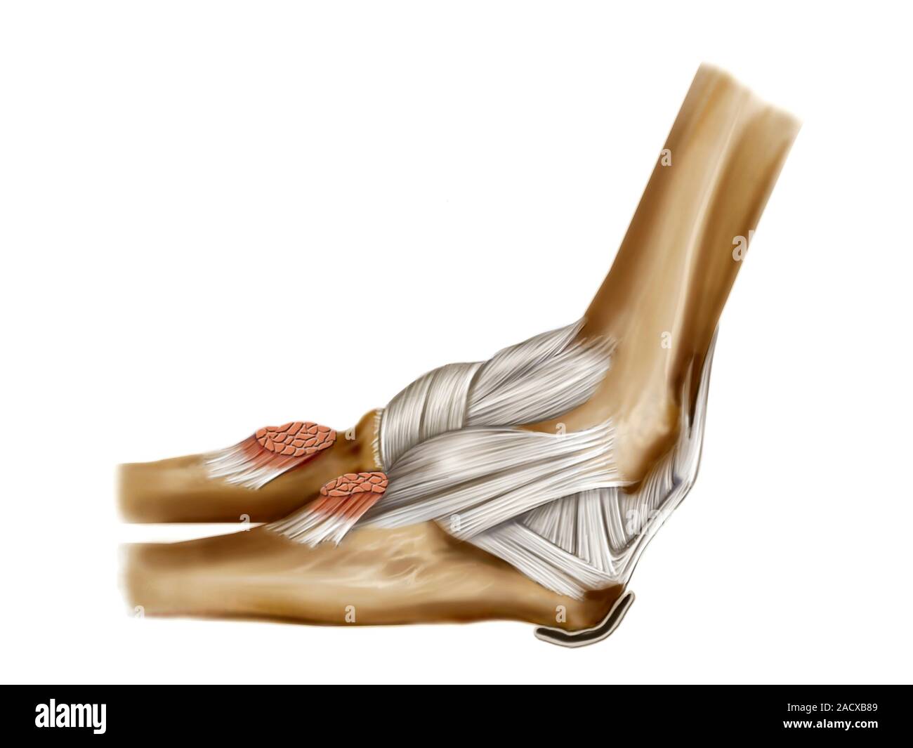 Illustration of the elbow joint. This medial view illustration is from ...