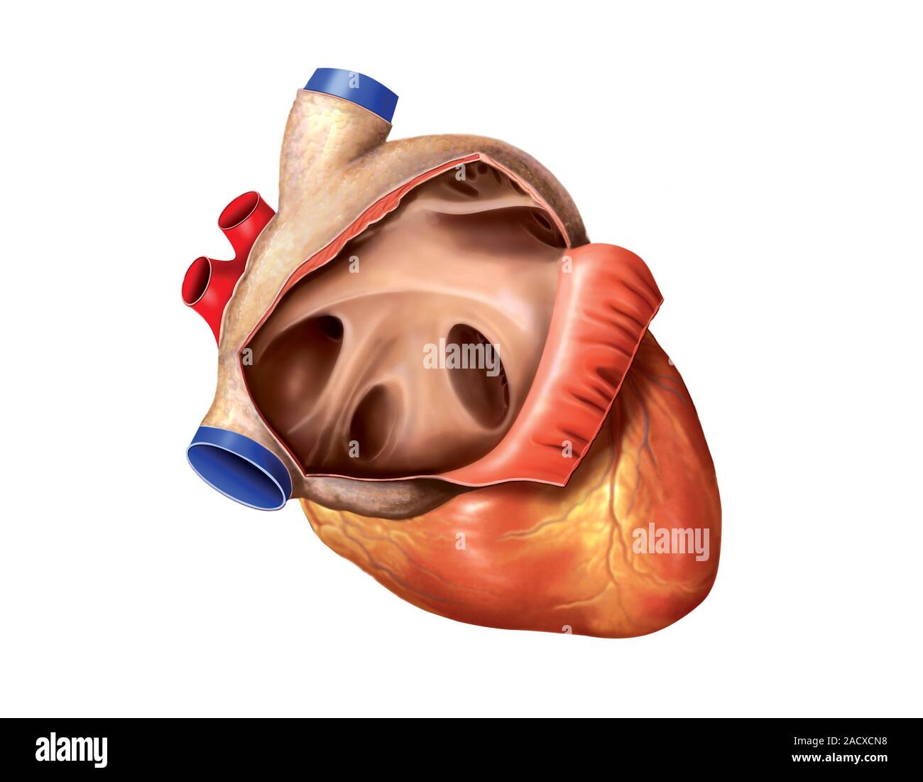 Illustration of the Heart and right atrium of newborn. This anterior ...