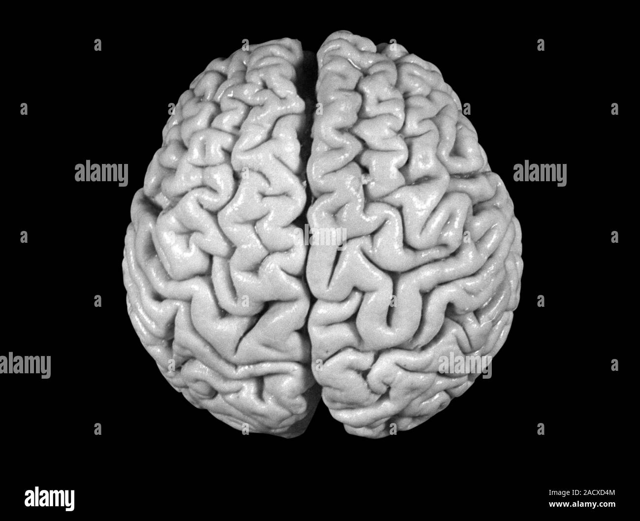 Einstein's brain, from above. During the autopsy of the German-Swiss-US ...