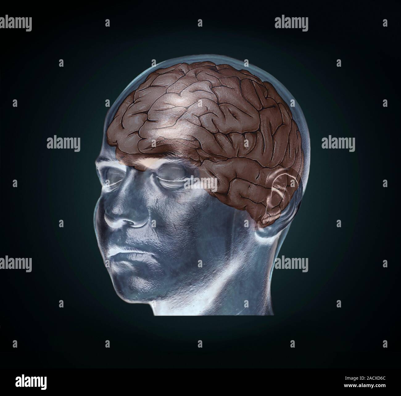 Healthy brain of a 32 year old man, 3D magnetic resonance imaging (MRI ...