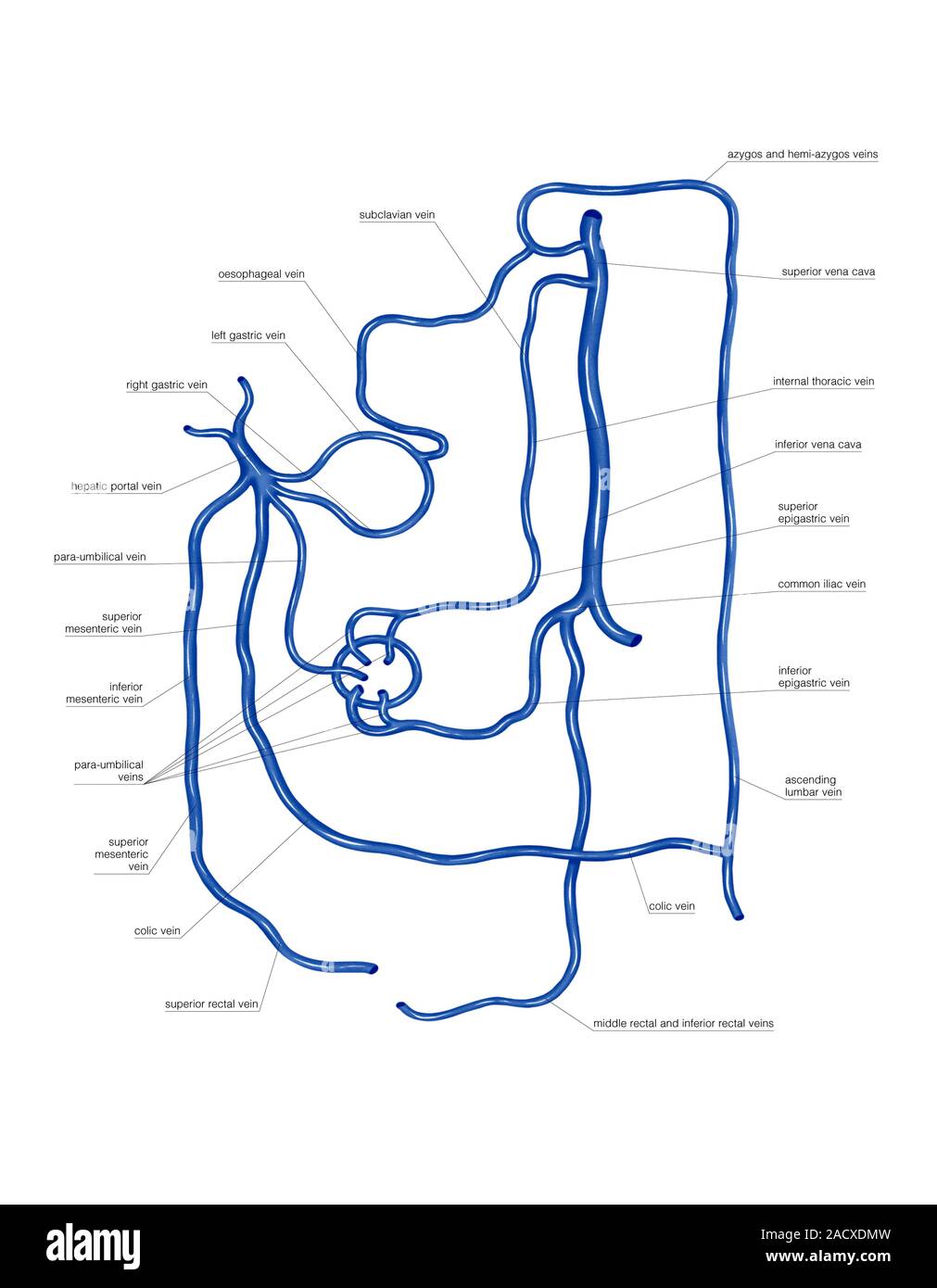 Illustration of the portal vein network and collateral vessels. This ...