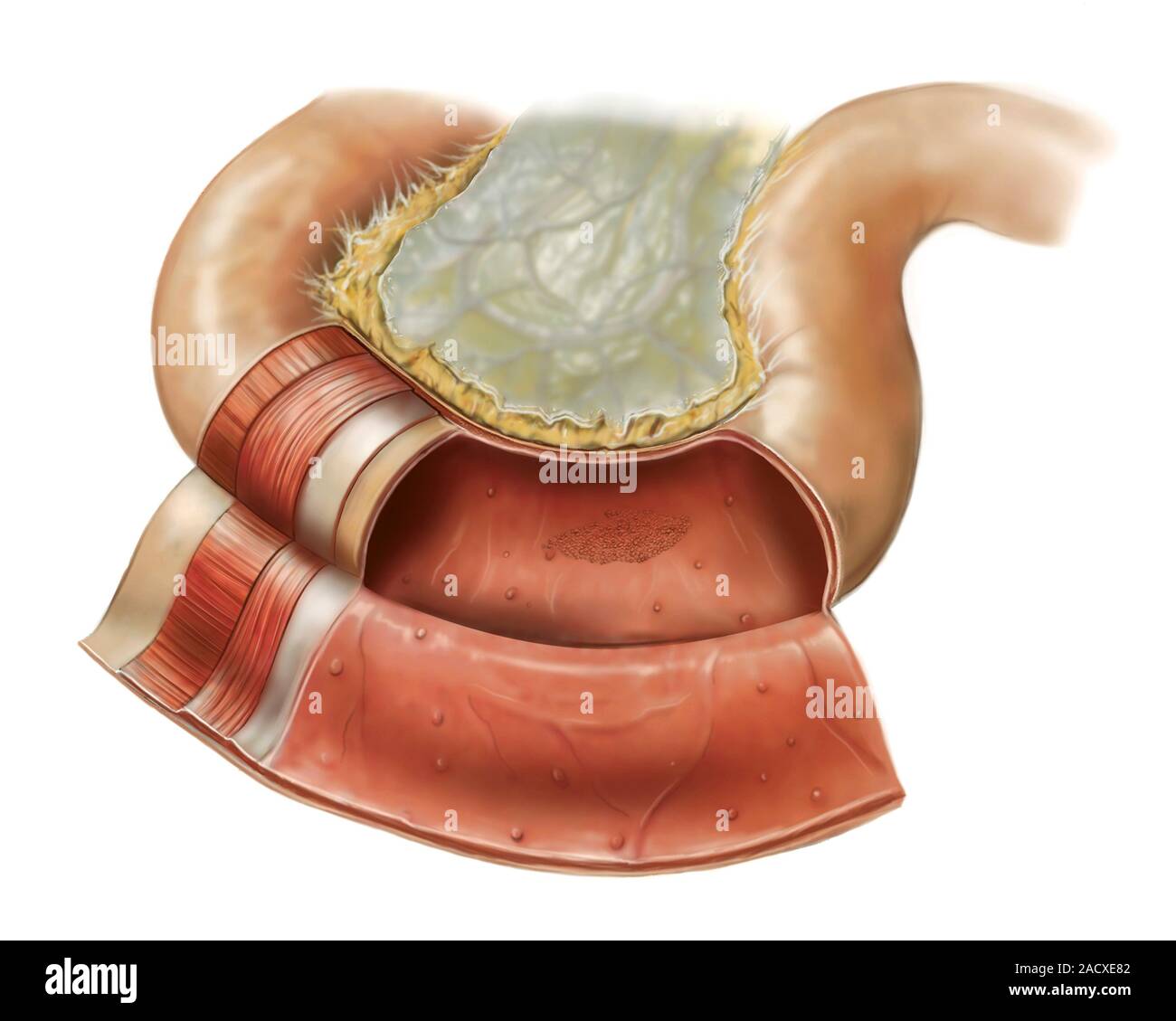 Illustration of the Ileum. This view illustration is from 'Asklepios ...